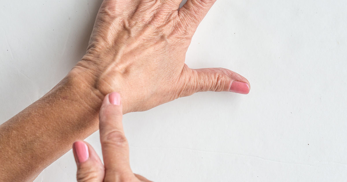 Surgical ganglion removal - Warsaw and Płock | OpenMed Medical Centre