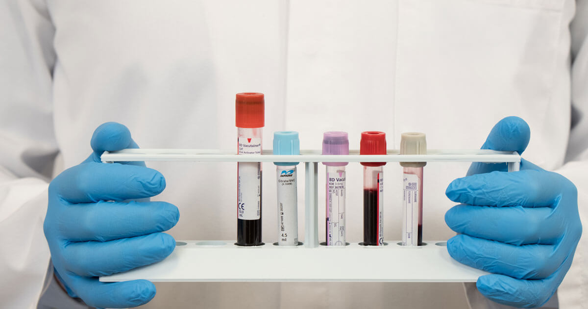 Full blood count and urinalysis Warsaw and Płock | OpenMed Medical Centre