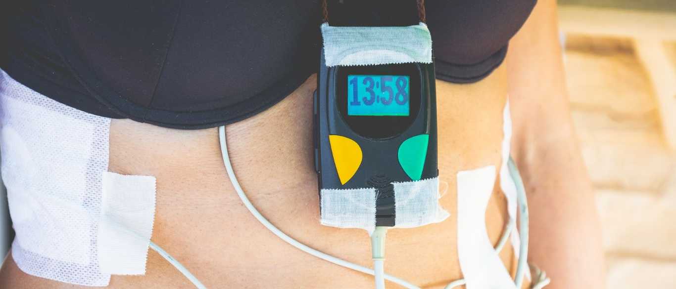 Holter EKG - na czym polega badanie i jak się do niego przygotować?